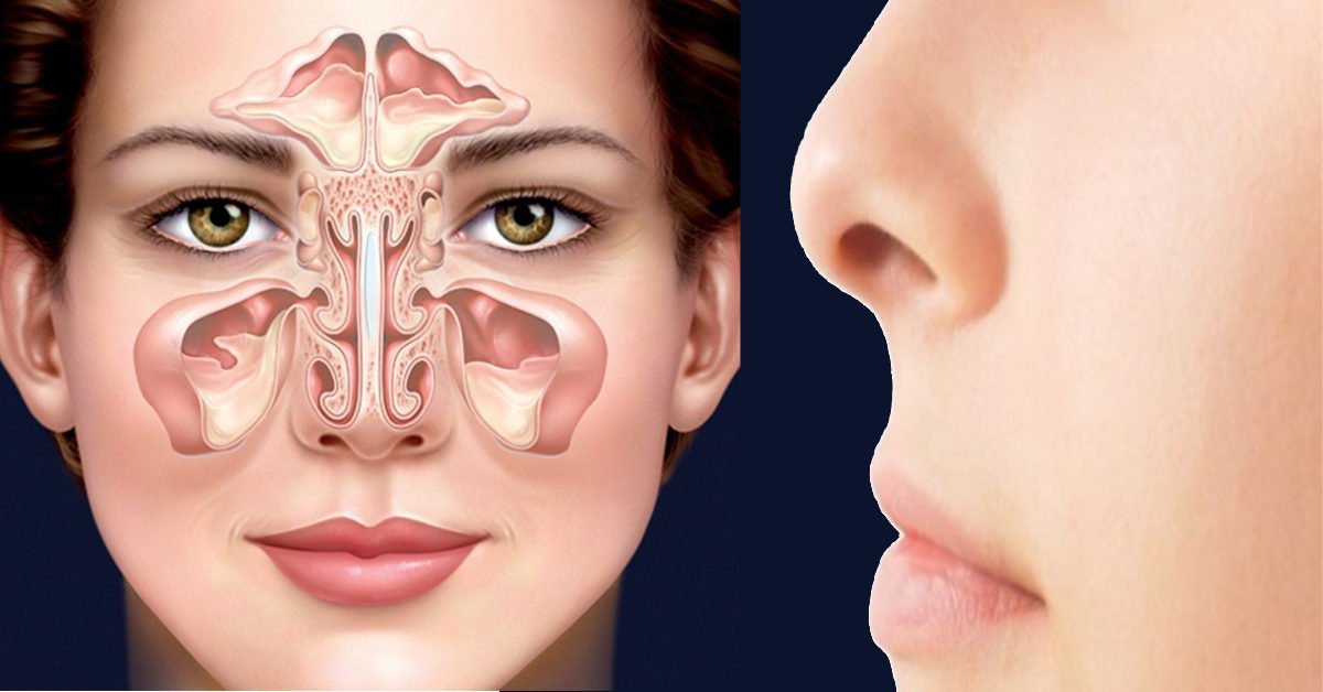 Konka Büyümesi Nedir? - Op. Dr. Sezai Sevengil
